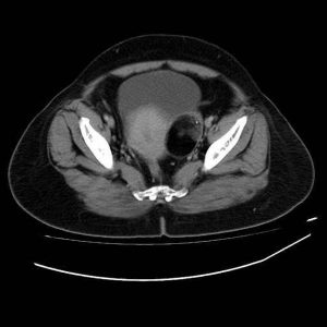 Incidentaloma Guidelines - rad-call.com