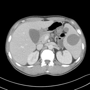 Incidentaloma Guidelines - rad-call.com