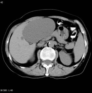Incidentaloma Guidelines - rad-call.com